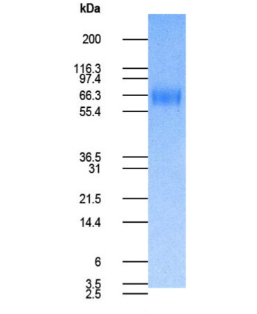 Human CD80 Recombinant Fc fusion Protein Biotin Conjugated|21-1002-B