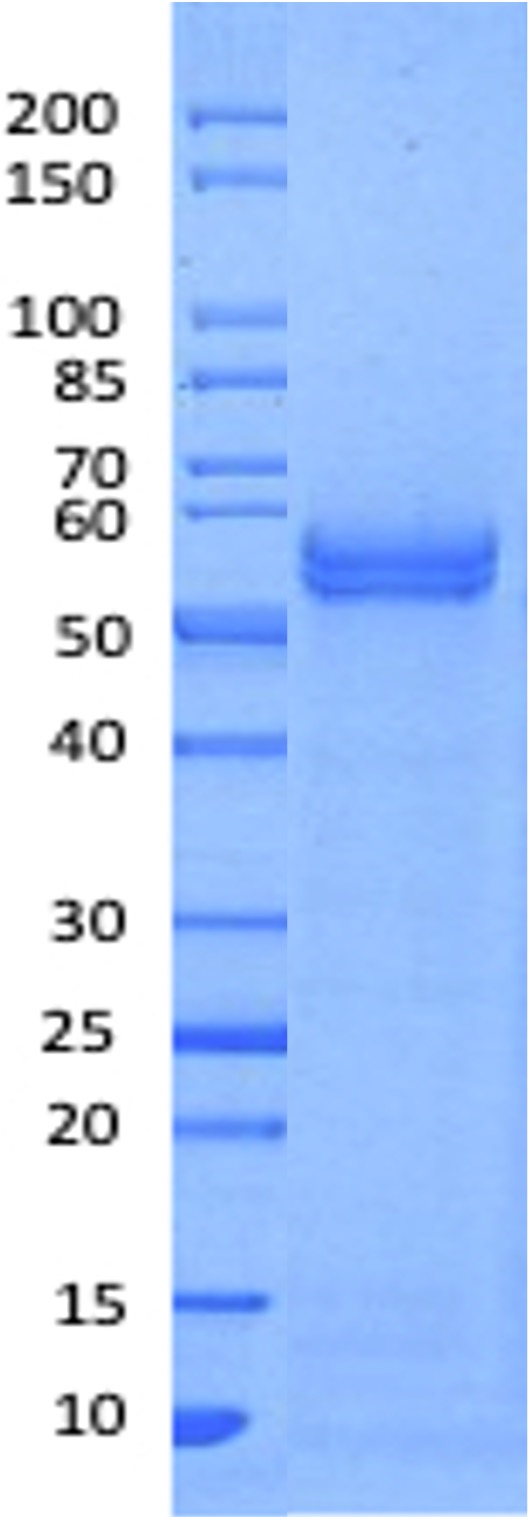 Recombinant Human IL-15 Receptor a & IL-15 Fusion Protein