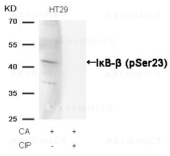 Anti-IkB-beta Antibody | NF-kBIB