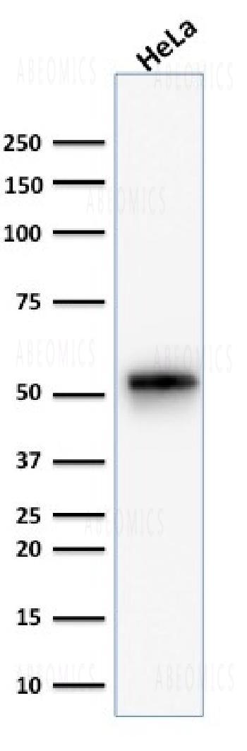 Anti Cytokeratin 7 Monoclonal Antibodyclone Krt71499r