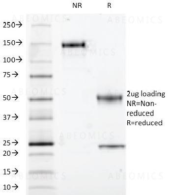Anti-S100B Monoclonal Antibody(Clone: S100B/1012)